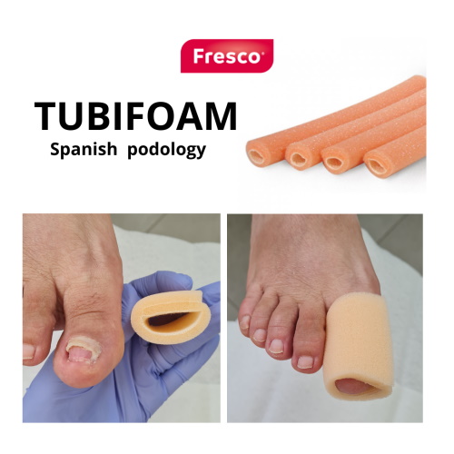 צינור ספוג רפואי TUBIFOAM להגנת אצבעות