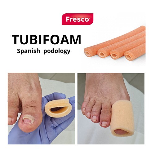 צינור ספוג רפואי TUBIFOAM להגנת אצבעות
